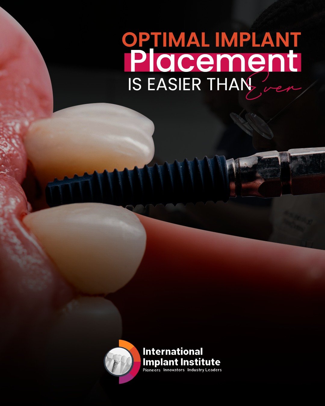internationalimplant | Land Clinic